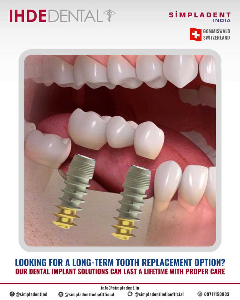 Best IHDE Dental Implants India